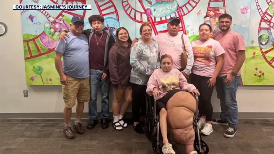 Bradenton Teen Heads Home After 17-Hour Surgery to Amputate Tumor ...